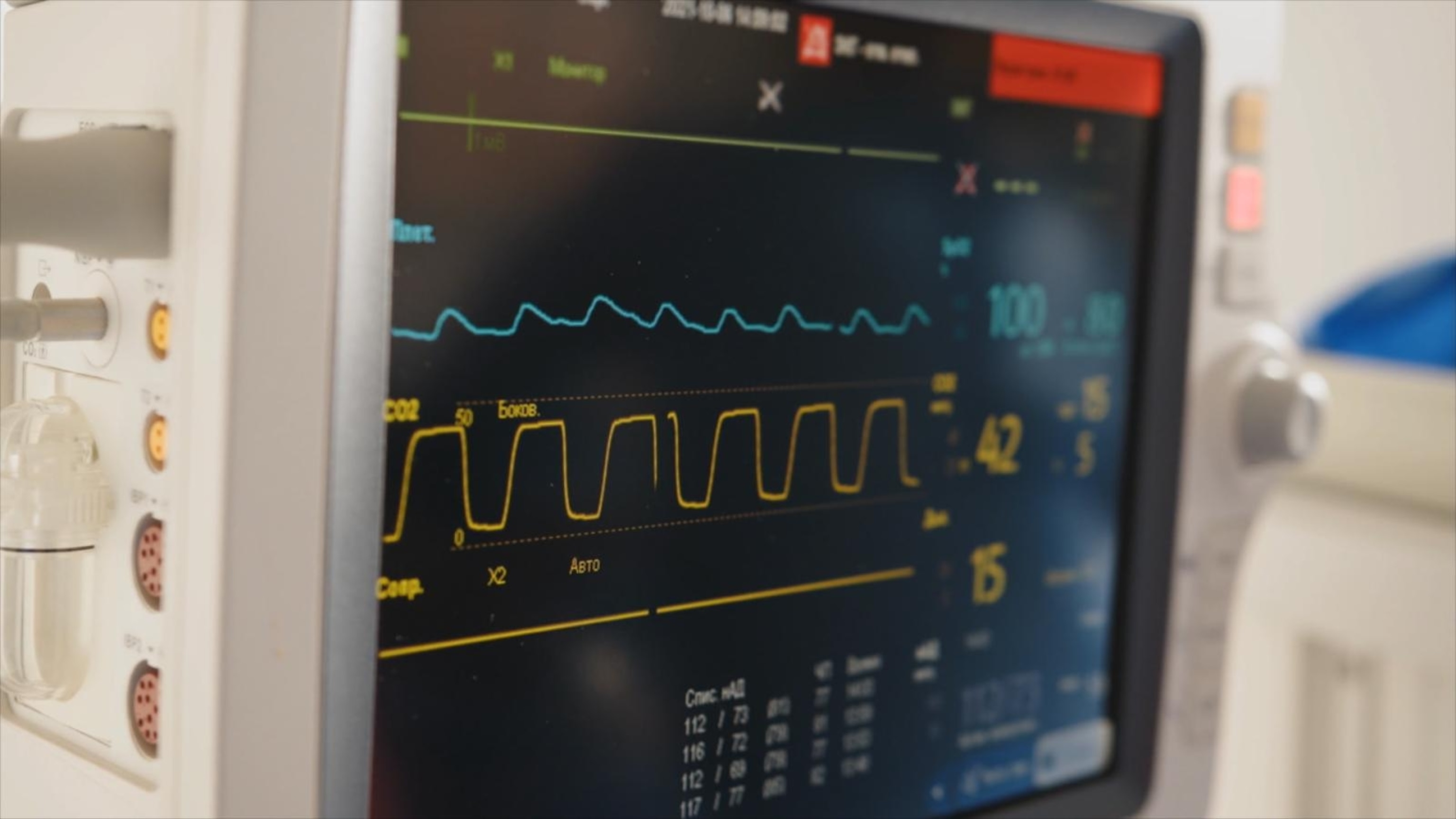 New study links heart attacks to higher risk of dementia