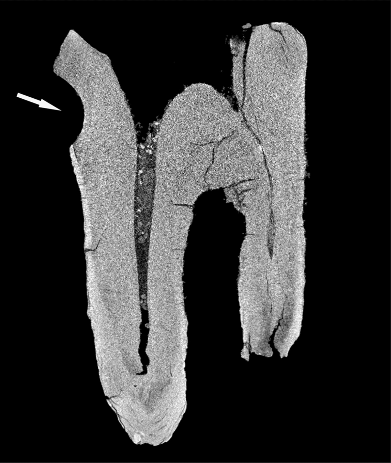 Scientists uncover 59,000-year-old Neanderthal tooth in Siberian cave ...