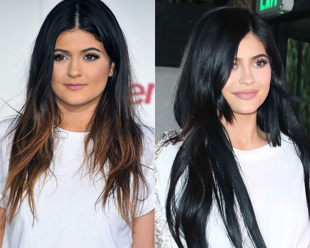 Kylie Jenner before & after plastic surgery: photos with lip fillers & more