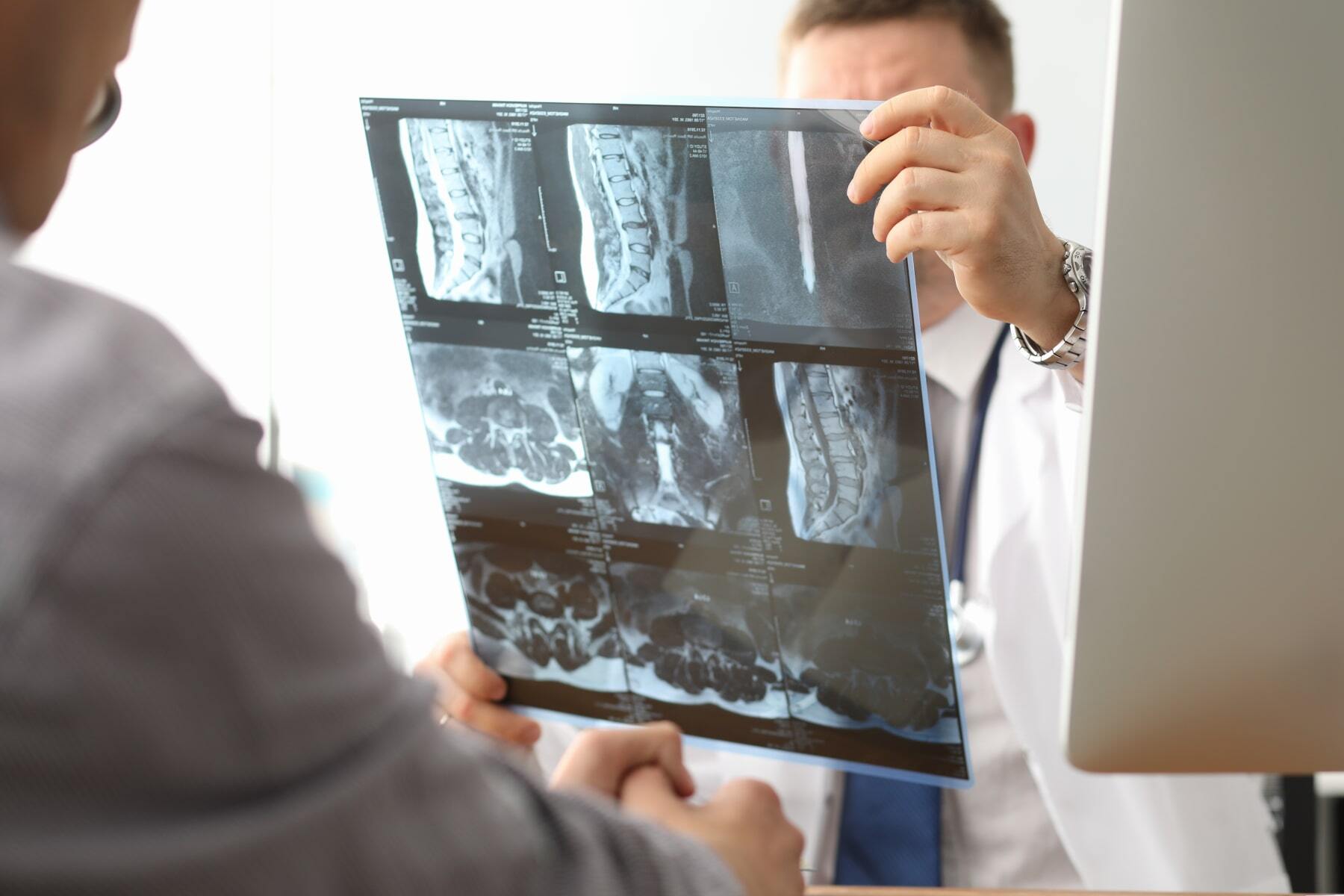 How to tell if you have a hernia: signs, symptoms, and treatment