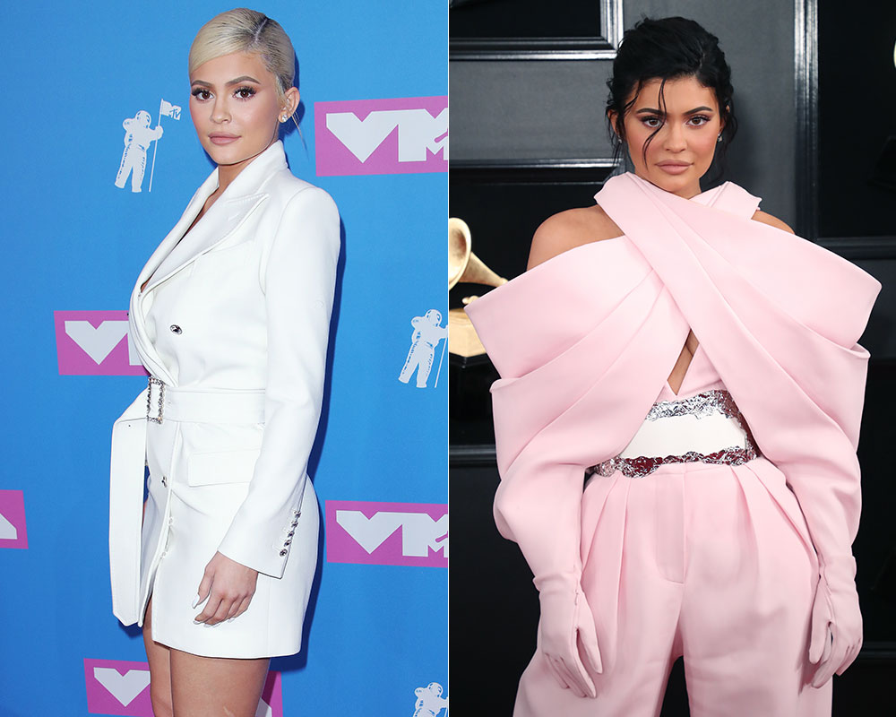Kylie Jenner before & after plastic surgery: photos with lip fillers & more