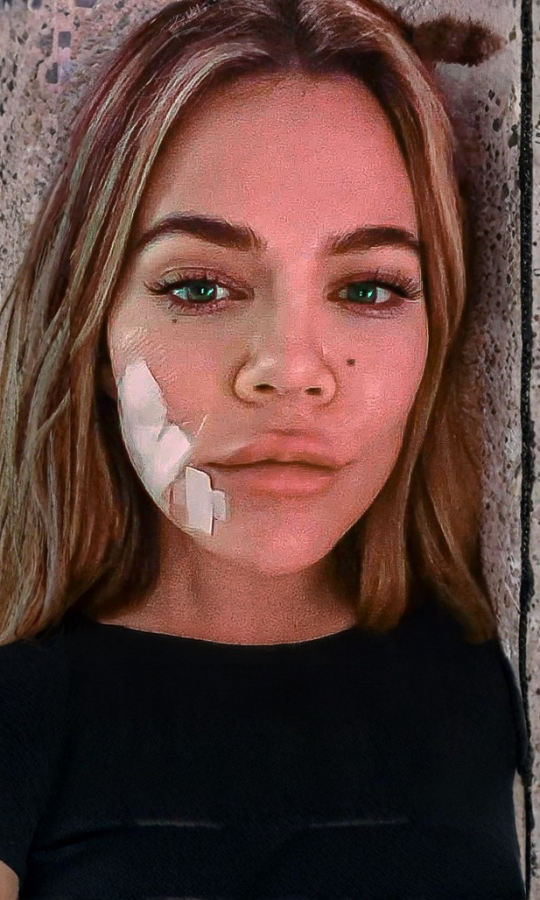 Khloe Kardashian reveals cancer damage
