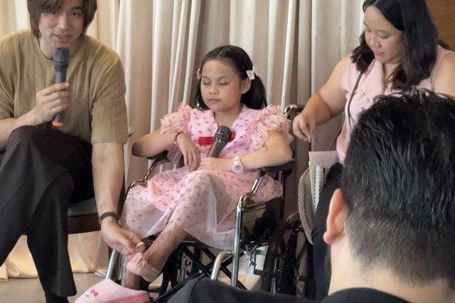 8-year-old fire victim chosen to take part in 'The Scar Project'