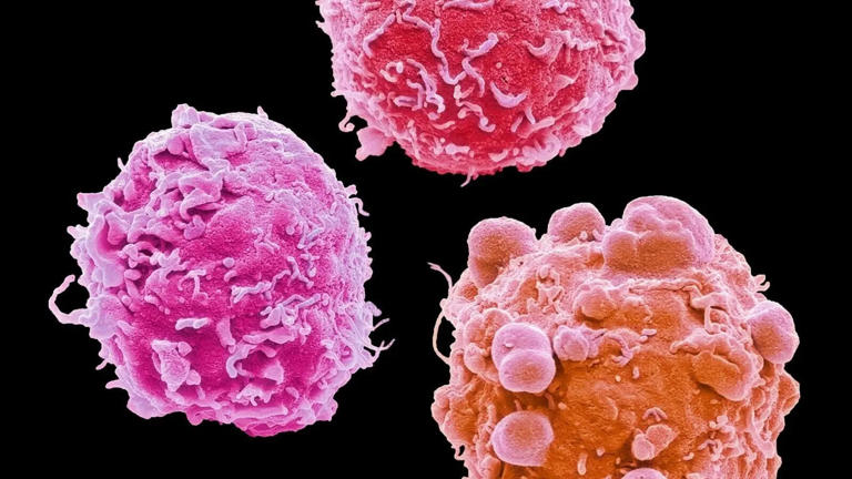 Starving cancer or starving the body? The hidden risk behind extreme no ...