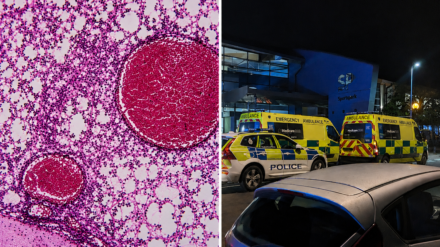 Meningitis outbreak sparks alarm after student dies and 2 others fall ...