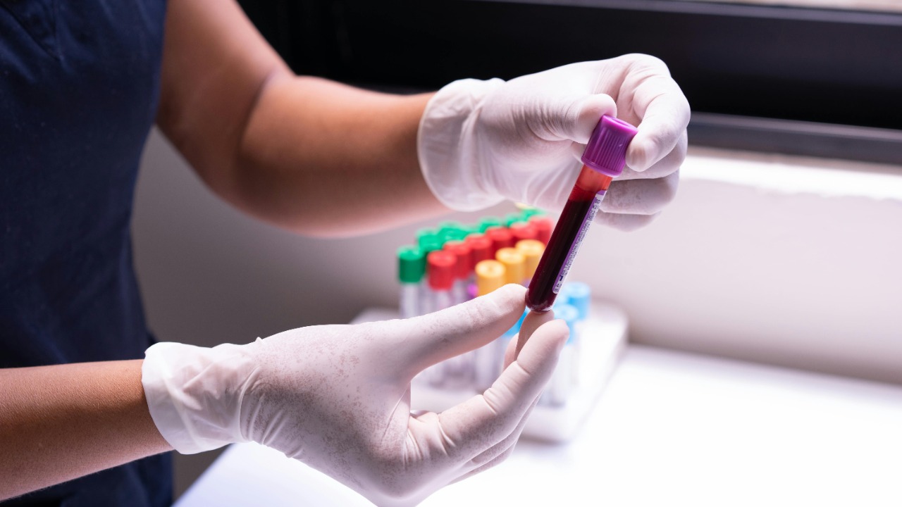 A landmark review just reversed decades of recommendations on a blood ...