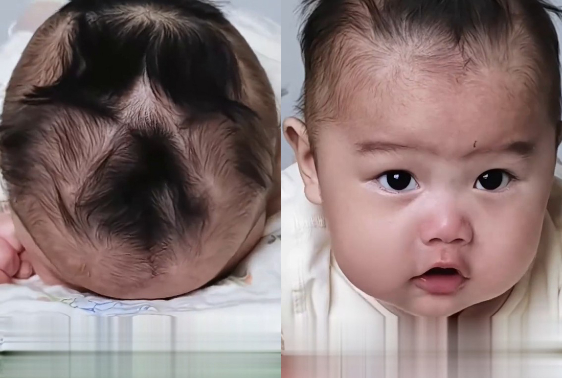 Bé trai có 9 xoáy tóc hiếm gặp