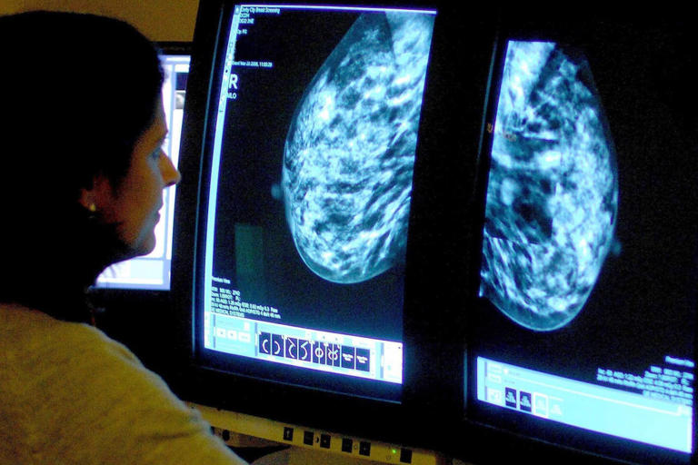 When should you get a mammogram? The latest information