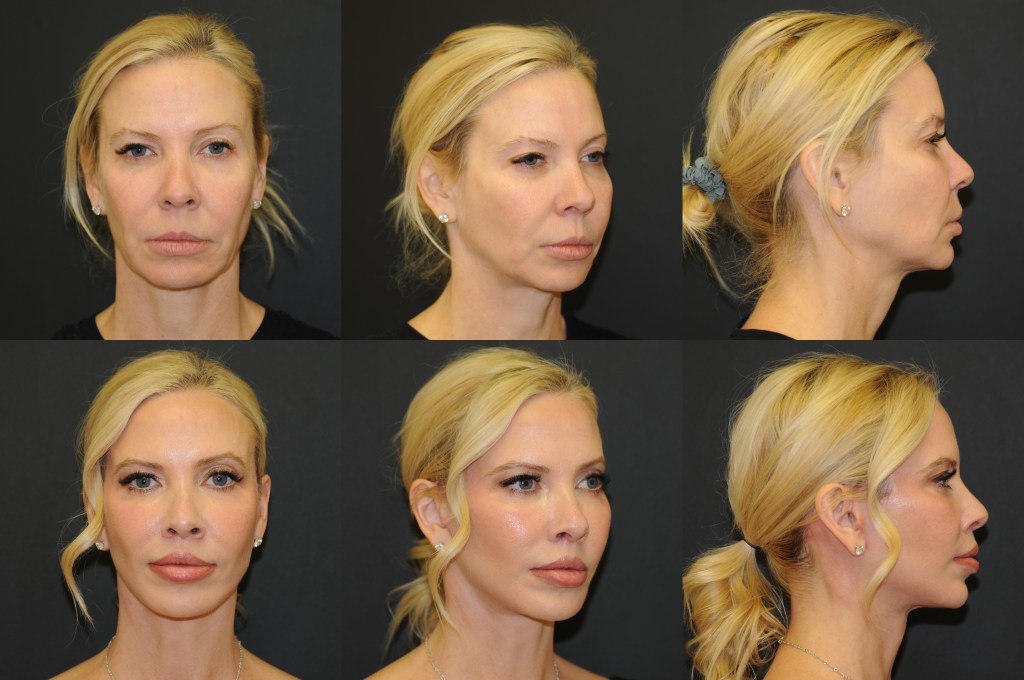 Relative beauty: NYC plastic surgeon operated on his entire family ...