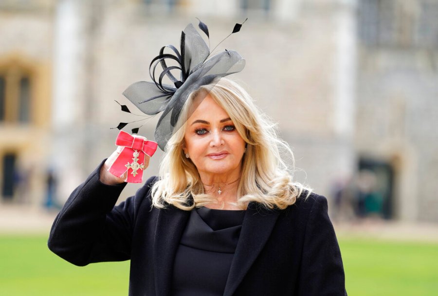80s singer Bonnie Tyler in medically induced coma, remains seriously ...