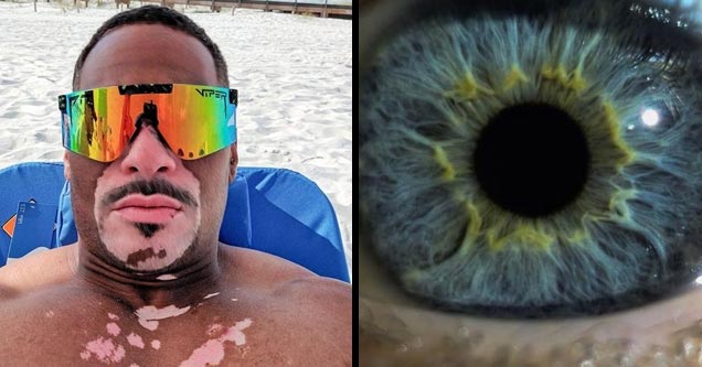 21 people share their unique body features