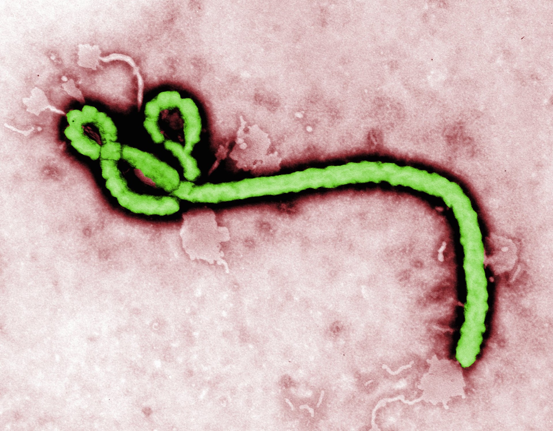WHO declares global emergency over rare Ebola strain