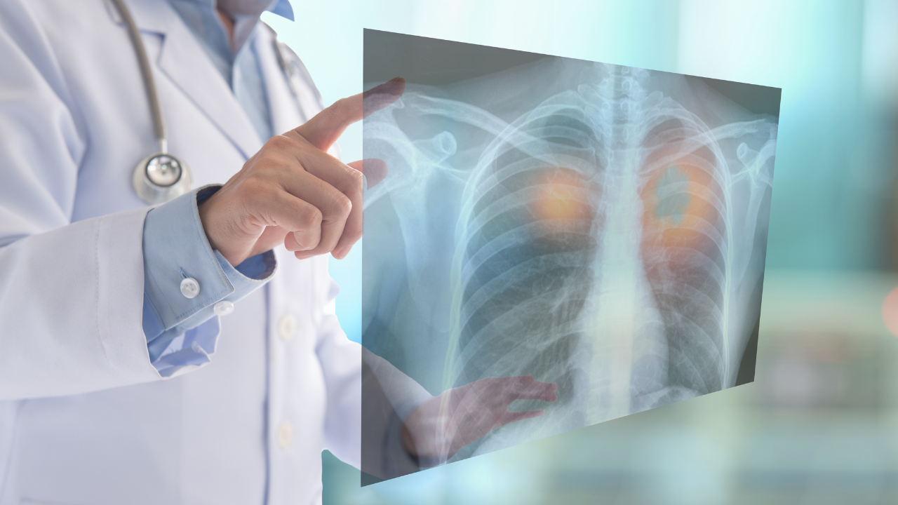 Not all cancers show warning signs early: Doctors explain why ignoring ...