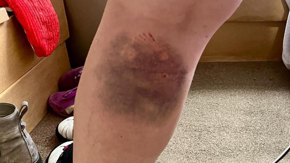 Plea to dog owners after delivery driver attacked