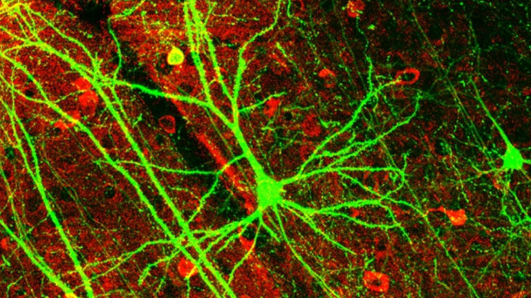 A cancer drug called saracatinib just switched failing brain synapses ...