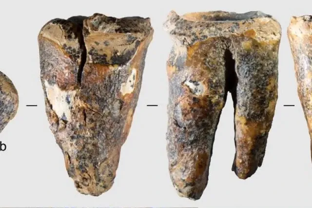 El misterio del primer odontólogo: hallan un diente neandertal que ...