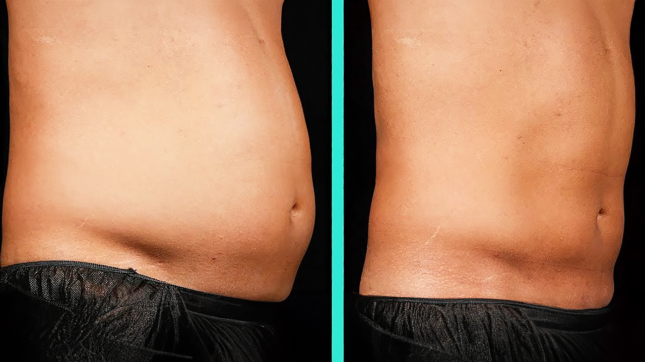 Natural methods for flattening the stomach explained
