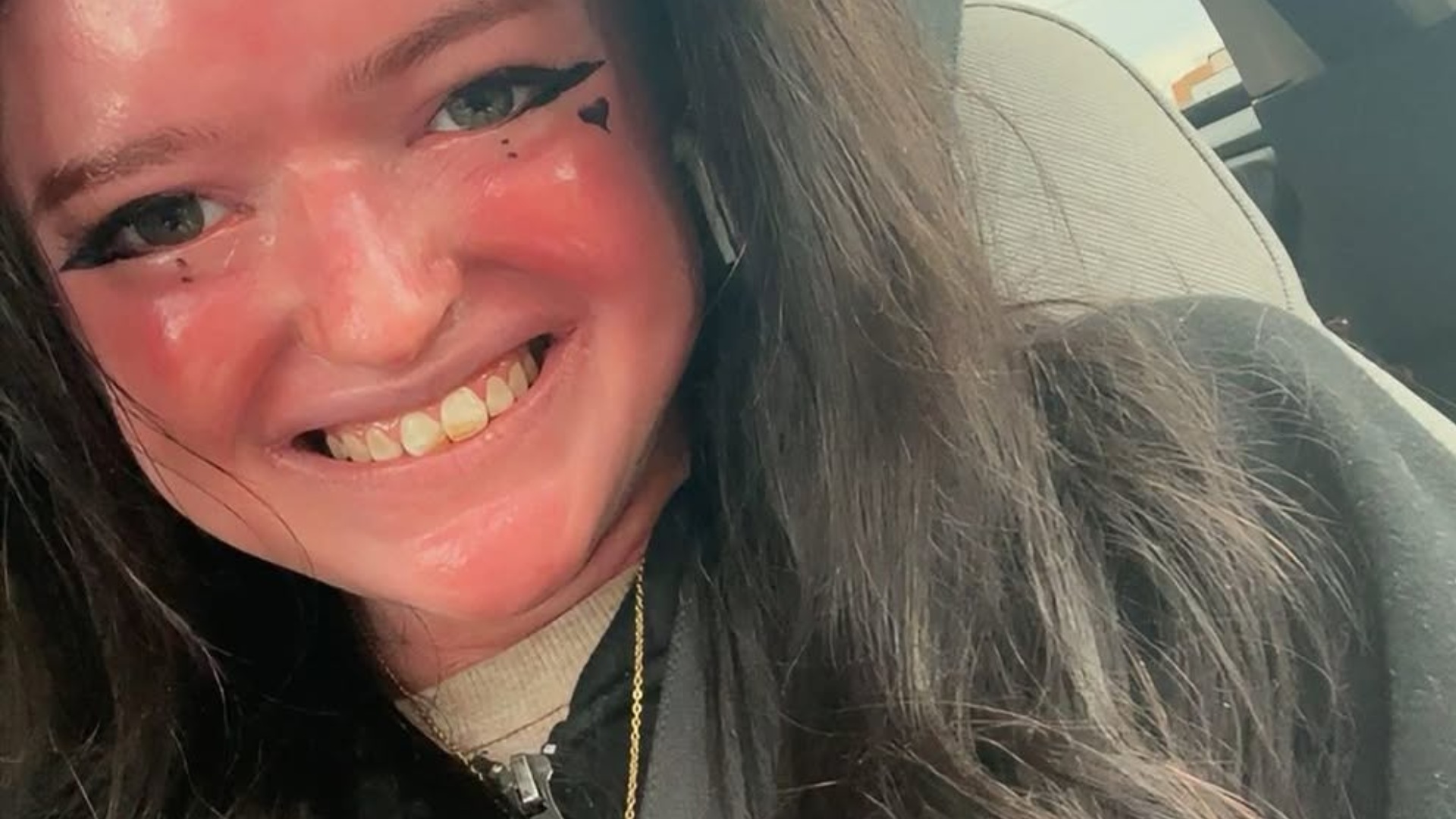 Suffering from a skin condition, she uses makeup as a tool for self ...