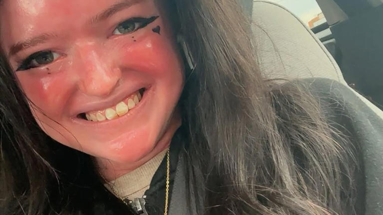 Suffering from a skin condition, she uses makeup as a tool for self ...