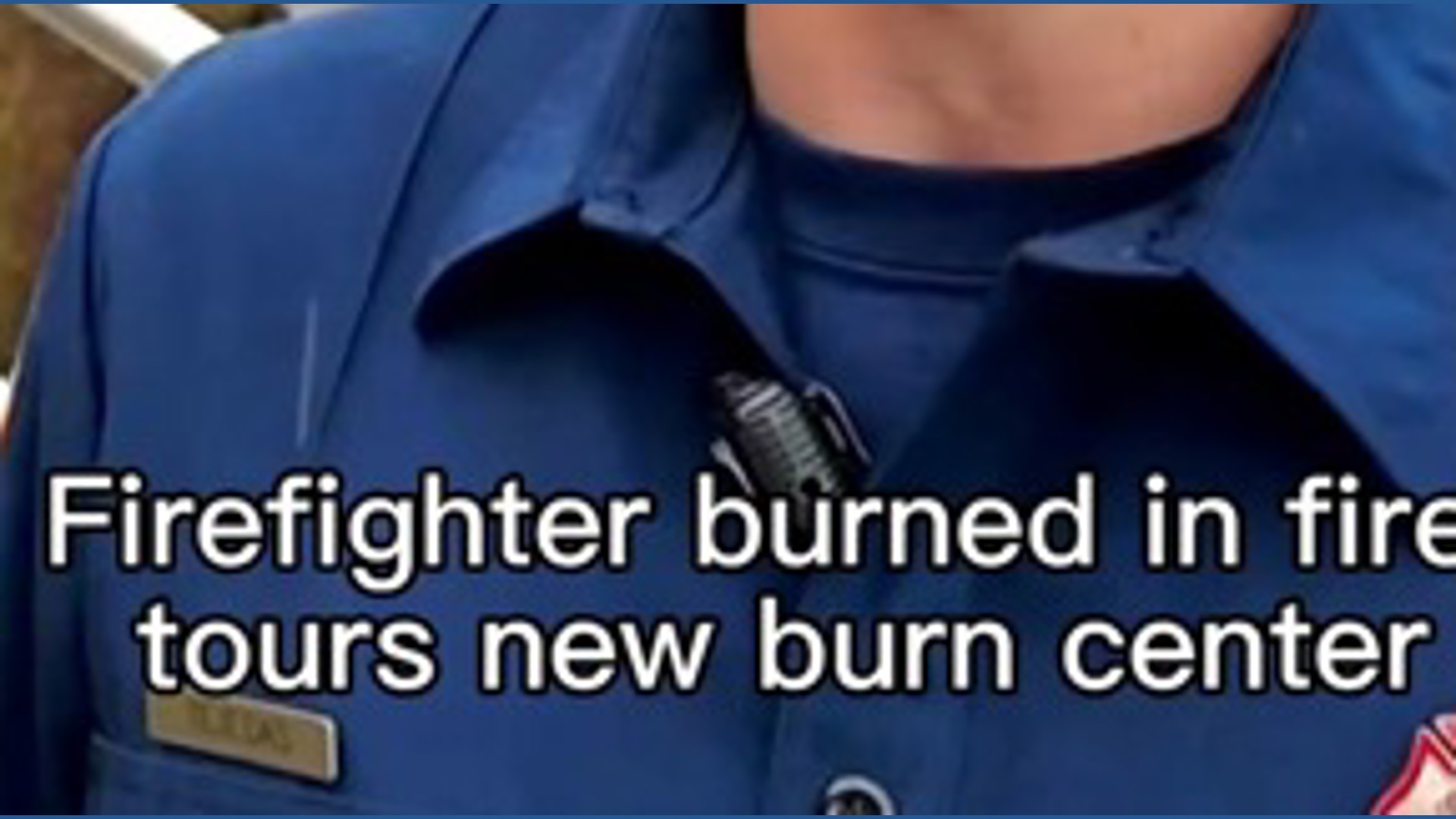Legacy reveals new Oregon Burn Center