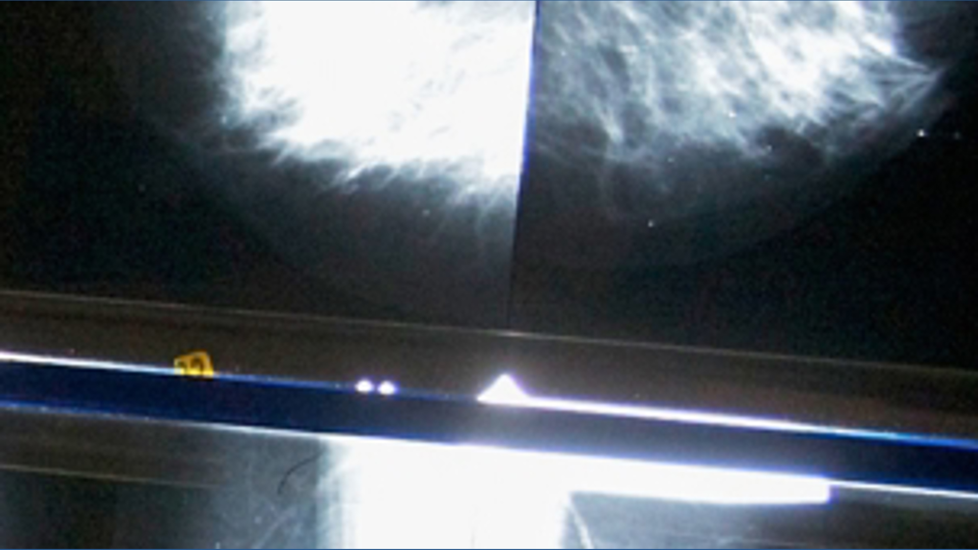 When should you get a mammogram?