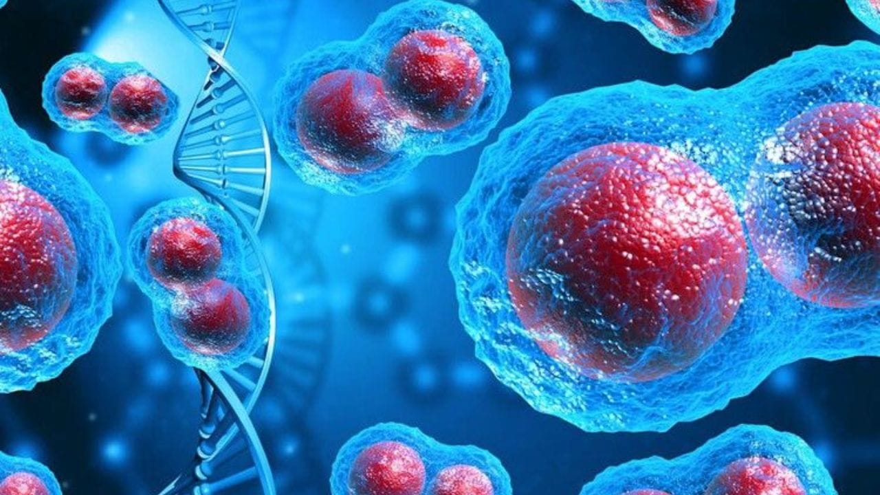 AI cuts radiotherapy planning time from weeks to hours in cancer ...