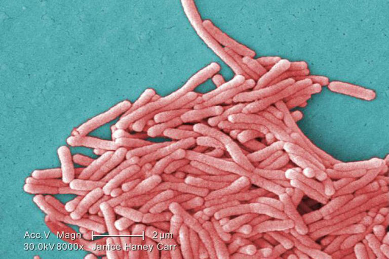 19 Legionella bacteria infections linked to Kaiser Bay Area hospital