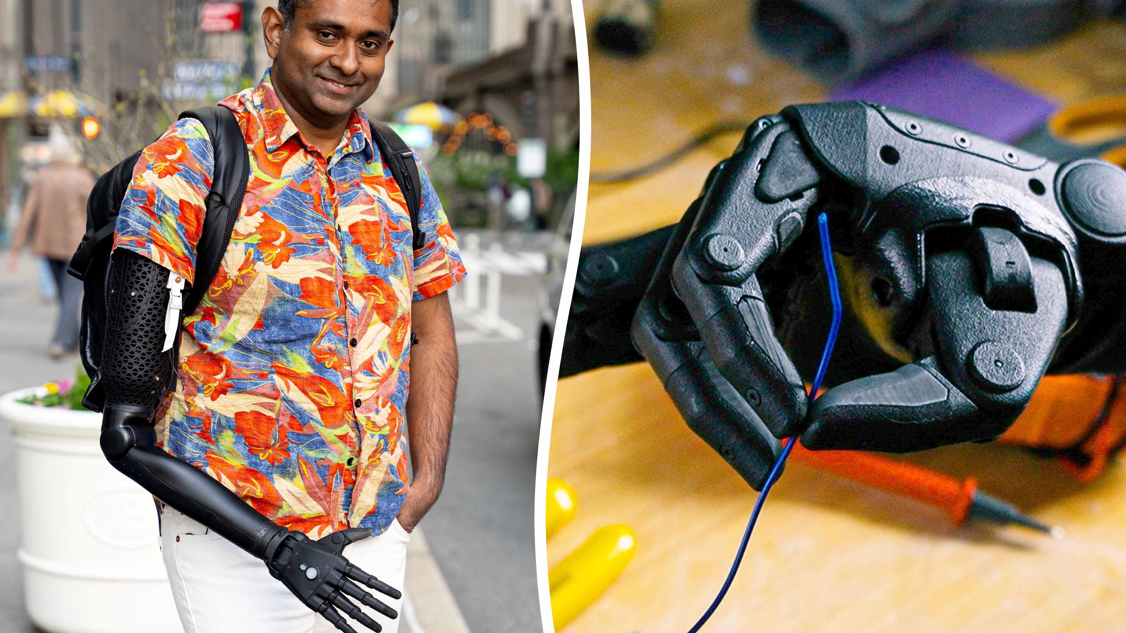 Amputee gets 'world first' whole 3D bionic arm - and can now walk his dog