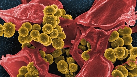 From hormones to genetics: Rheumatologist decodes why autoimmune ...