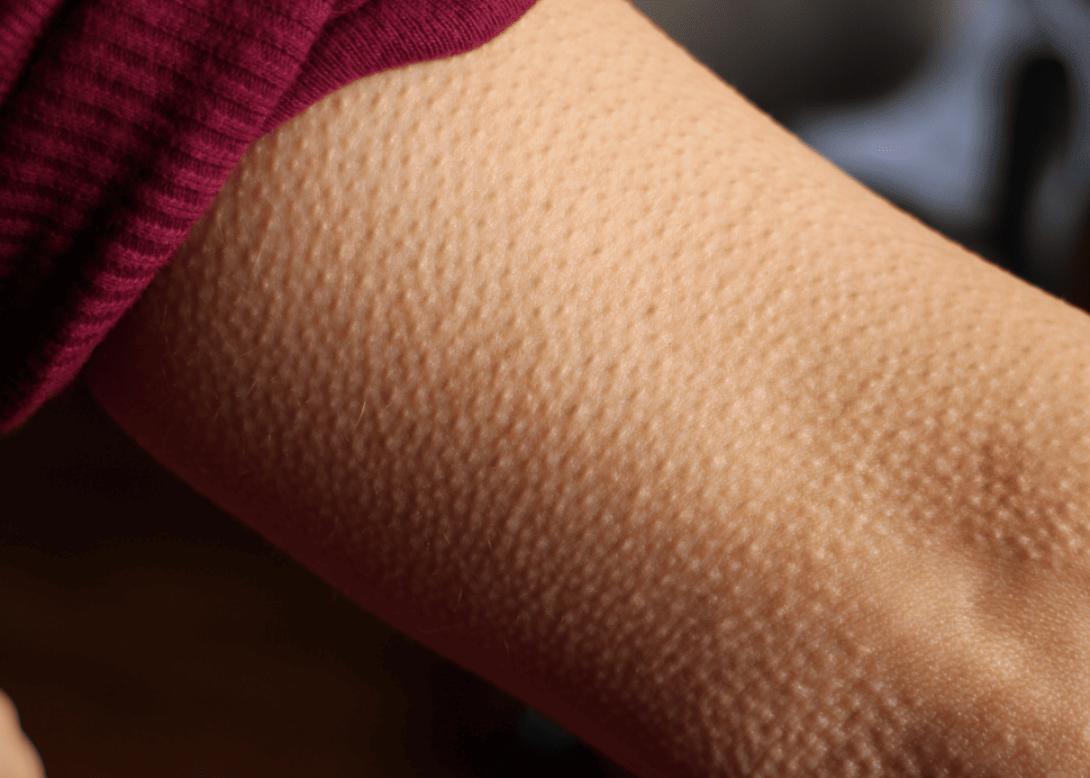 Wondering why your eyelid is twitching? See the most common bodily ...