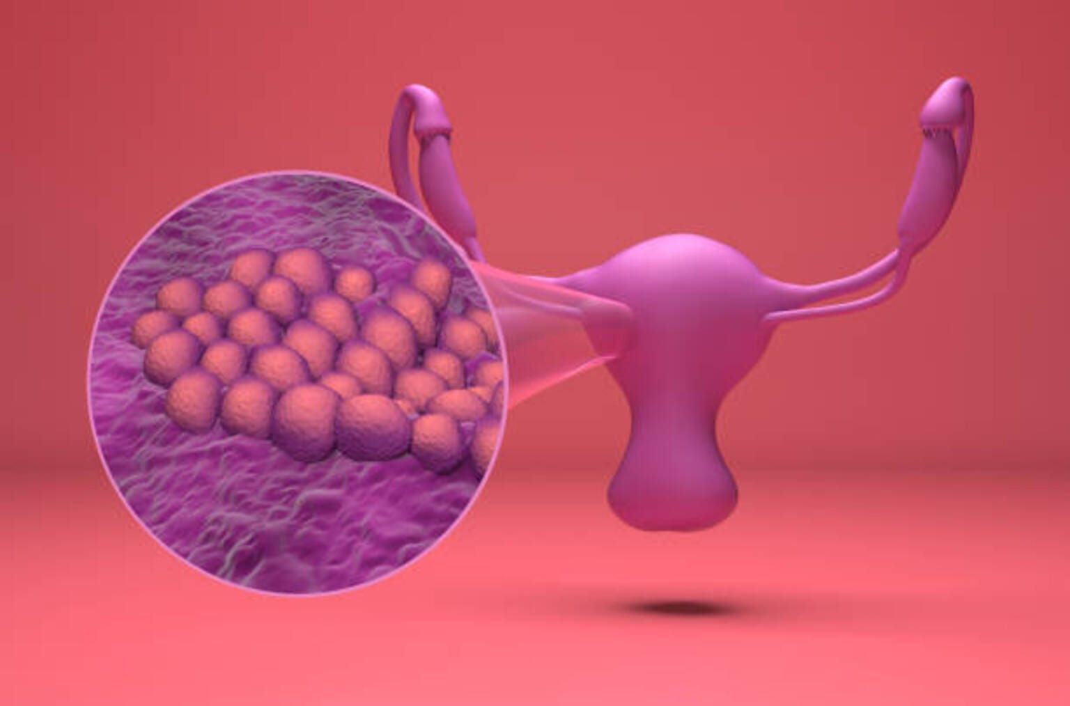 Merck's Sac-TMT meets both endpoints in phase 3 endometrial cancer trial