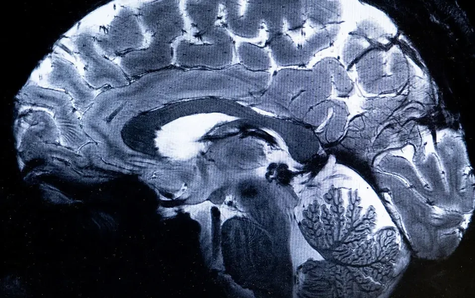 Understanding ataxia and the brain’s role in movement