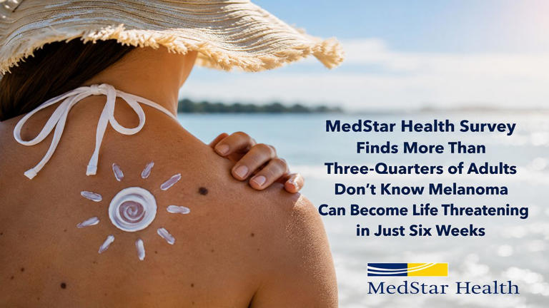 MedStar Health promotes sun safety during National Safe Sun Week