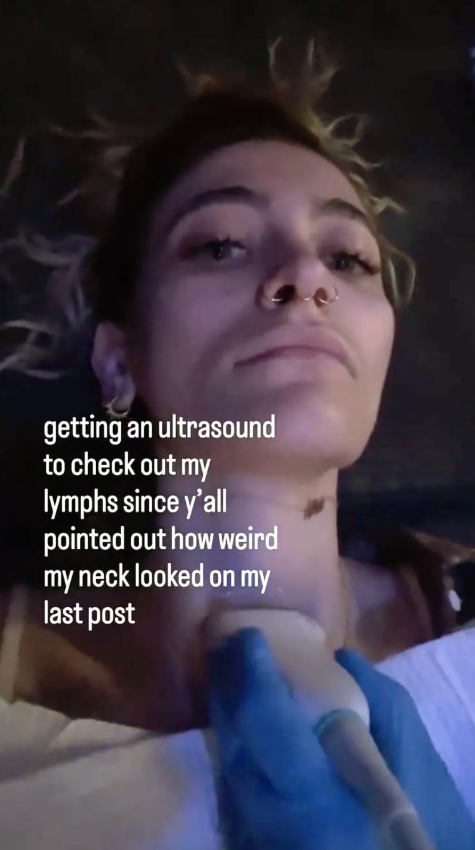 Paris Jackson opens up about health scare after fans noticed 'weird ...