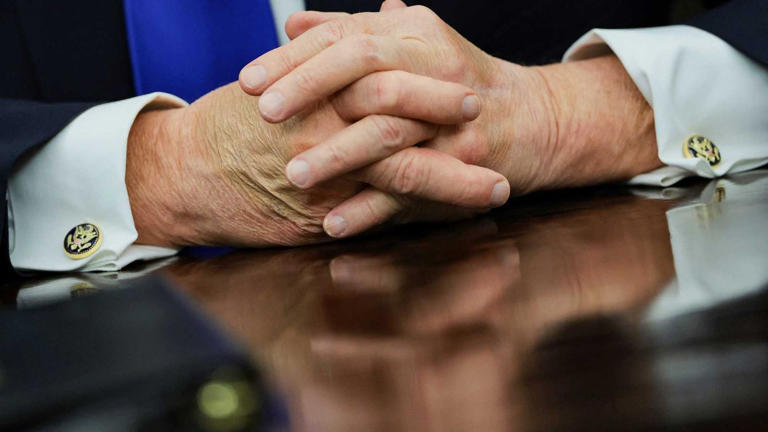White House silent as Trump's severely bruised hands spark fresh health ...