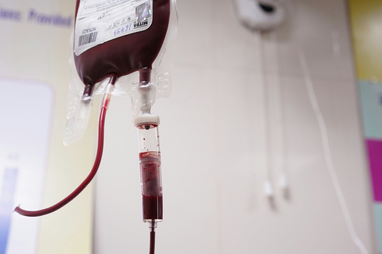 Inexpensive drug should be used in most major surgeries to prevent ...