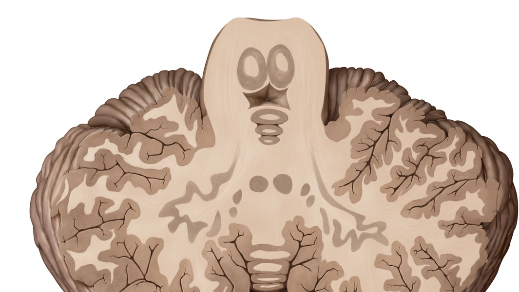 Understanding ataxia and the brain’s role in movement