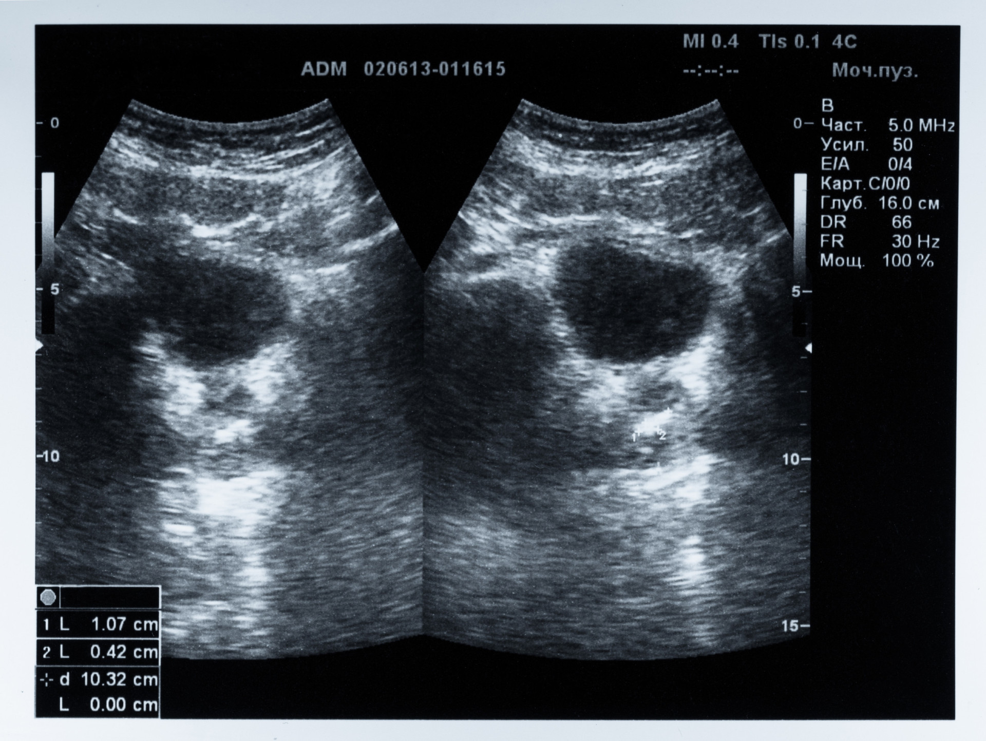 Is an enlarged prostate dangerous?