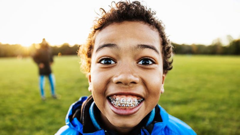 Ceramic braces: What you need to know
