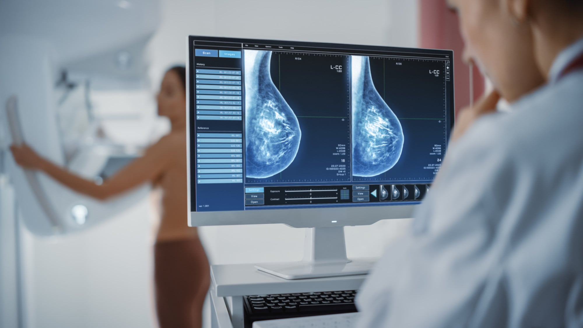 Who should get a mammogram and how often: 4 things to know about breast ...