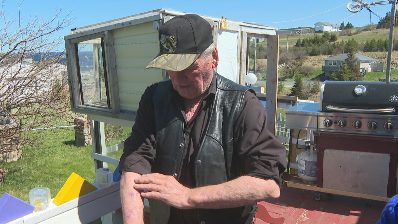 Pouch Cove residents still on edge after dog attacks, victim says