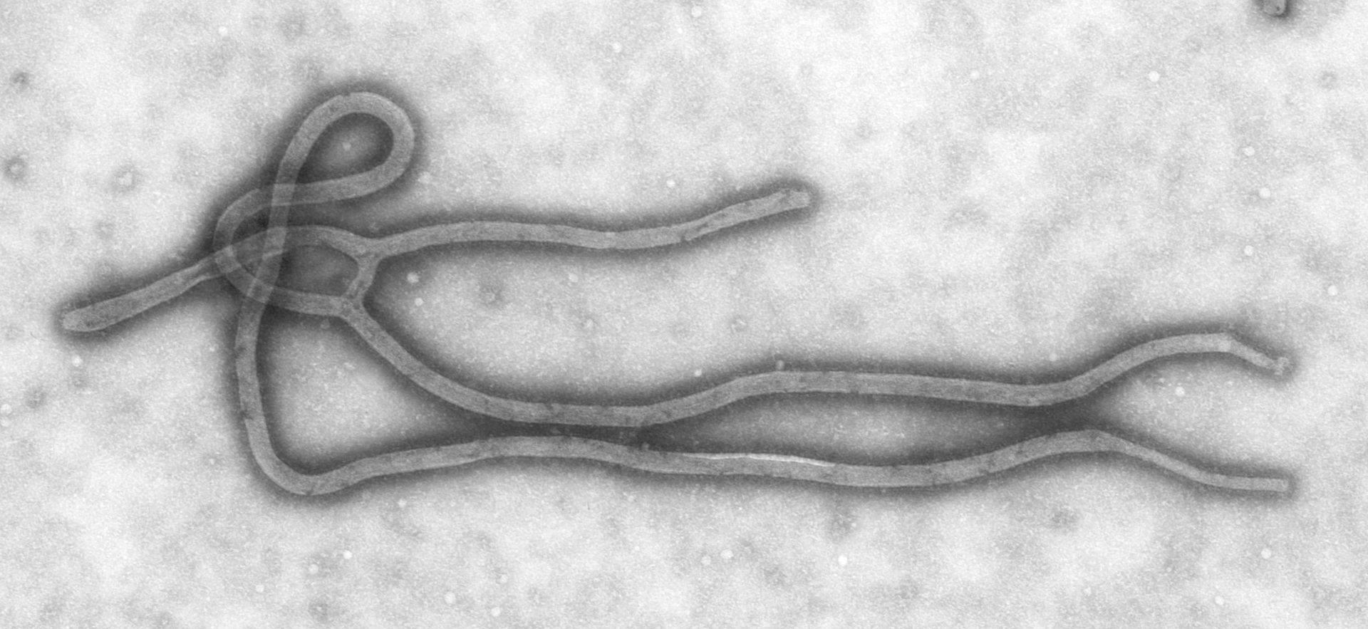 Ebola ceppo Bundibugyo: ultime notizie e informazioni utili