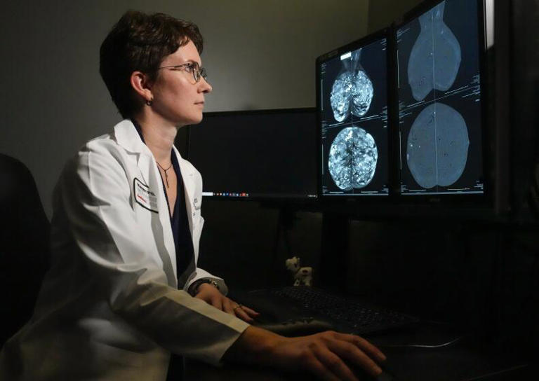 When should you get a mammogram? We sift through the conflicting advice