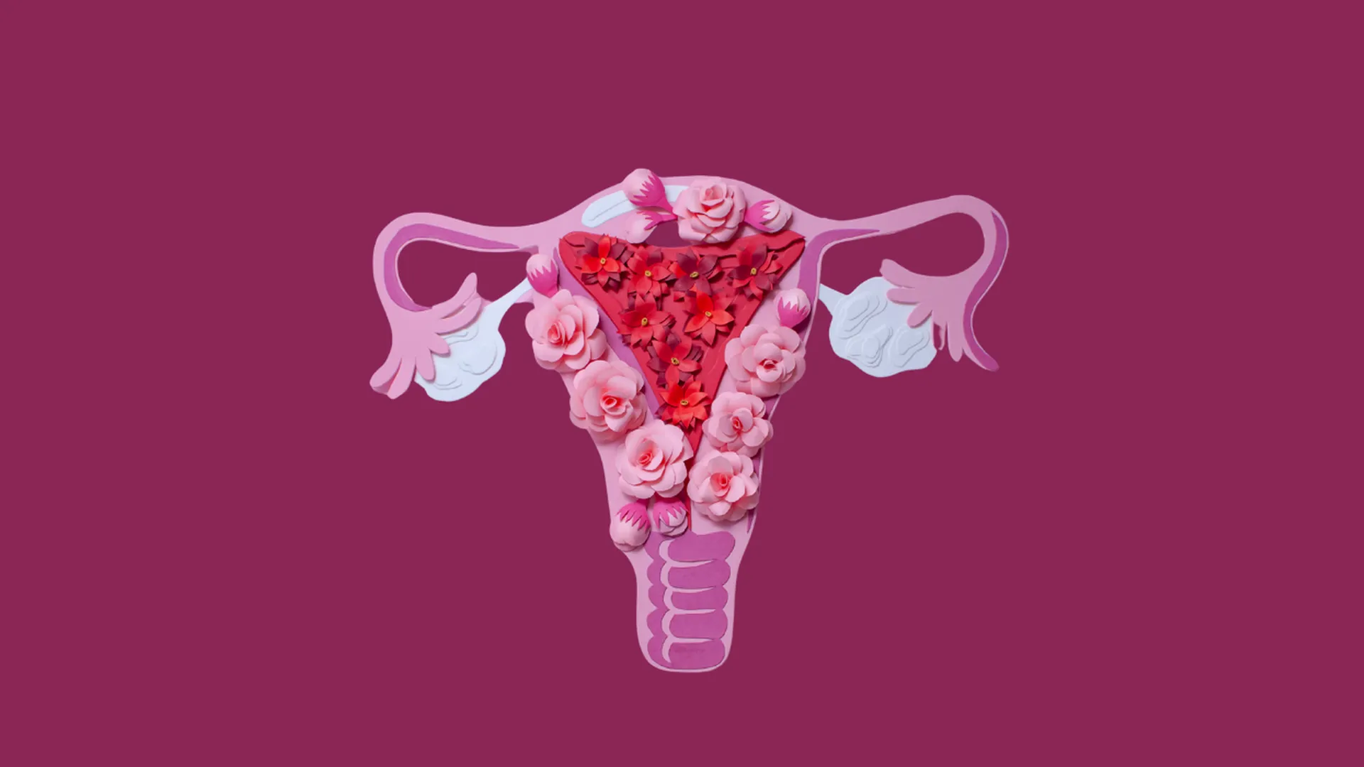 PCOS krijgt eindelijk een nieuwe naam en dit is waarom