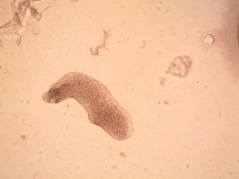 Brain-eating amoeba found in hot springs at 3 national parks, study warns