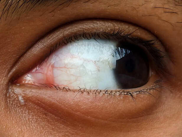 5 silent eye warning signs you should never ignore