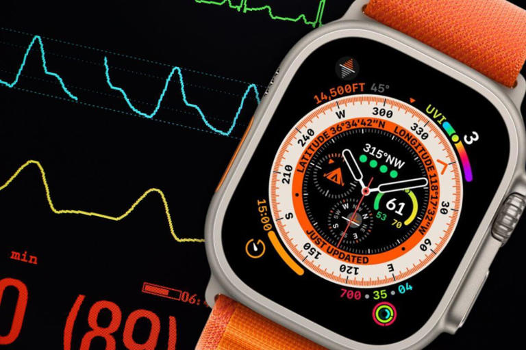 The Apple Watch on your wrist may already have hardware for a major ...