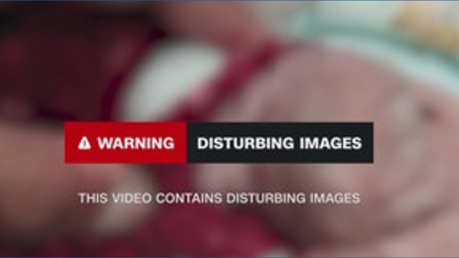 Skin conditions rise among children in Gaza