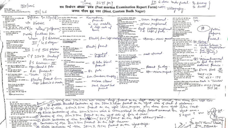 Greater Noida woman death: Post-mortem reveals head trauma, other ...