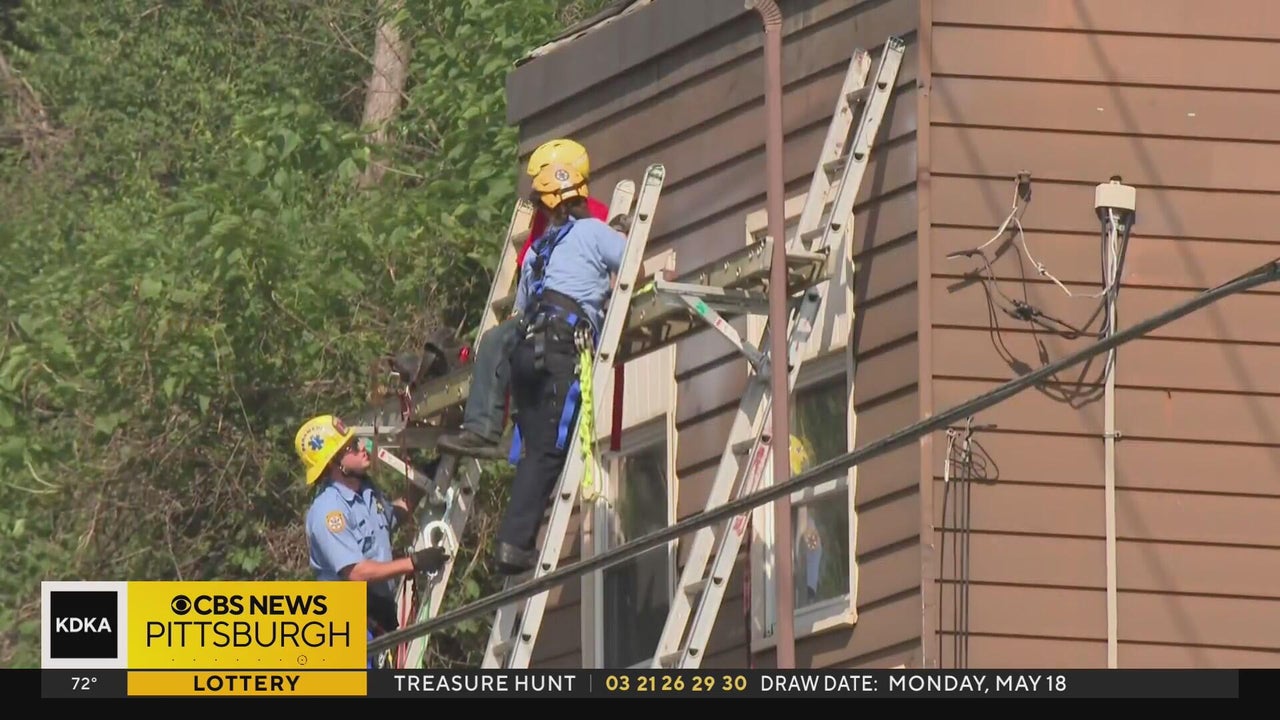 Worker recovering after being shocked and burned on jobsite